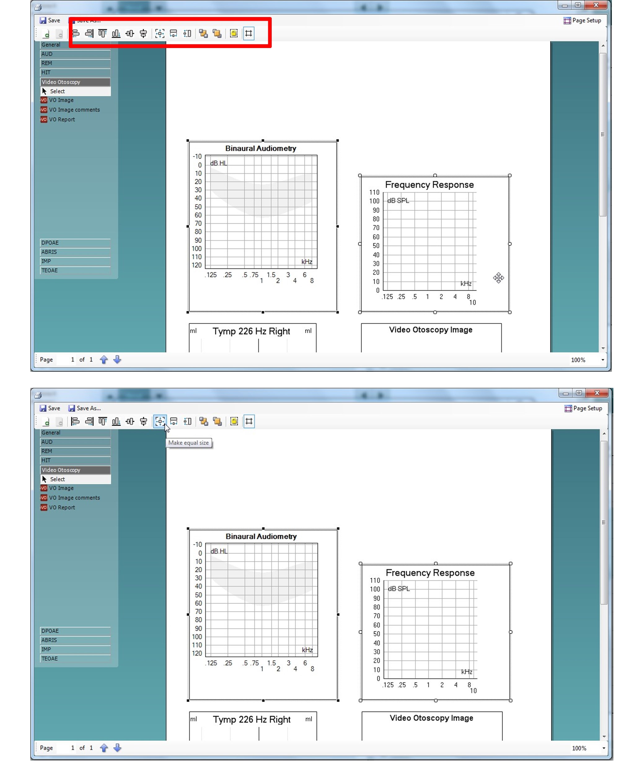 Affinity Compact | Customized Printout Setup | Interacoustics